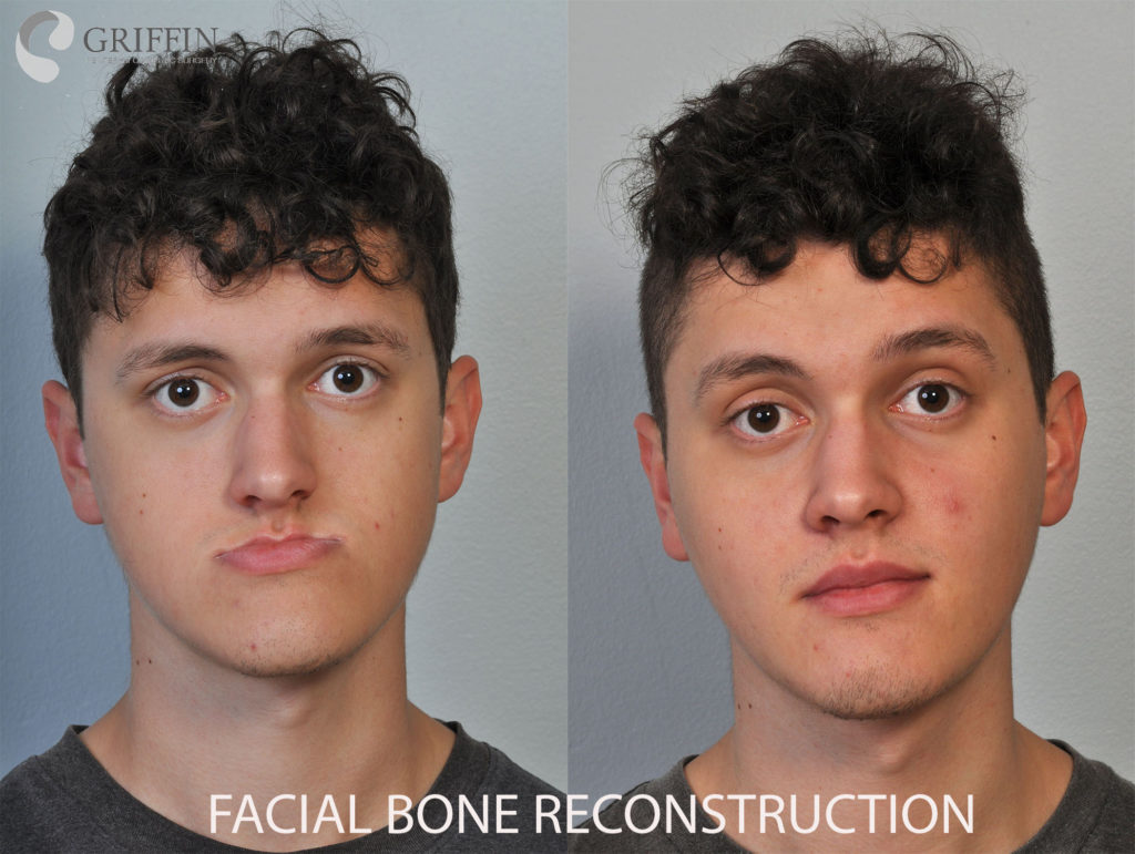 New Page Columbus MS, Griffin Center for Oral and Maxillofacial Surgery